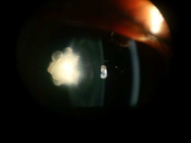 Nandhana Eye Hospital